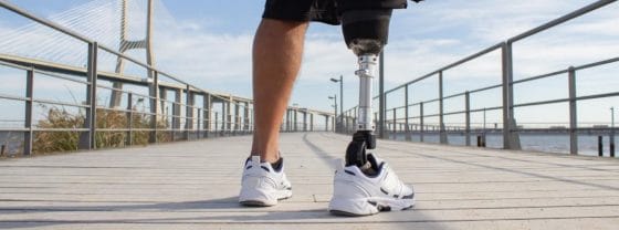 Prótese de perna pelo plano de saúde | Rosenbaum Advogados